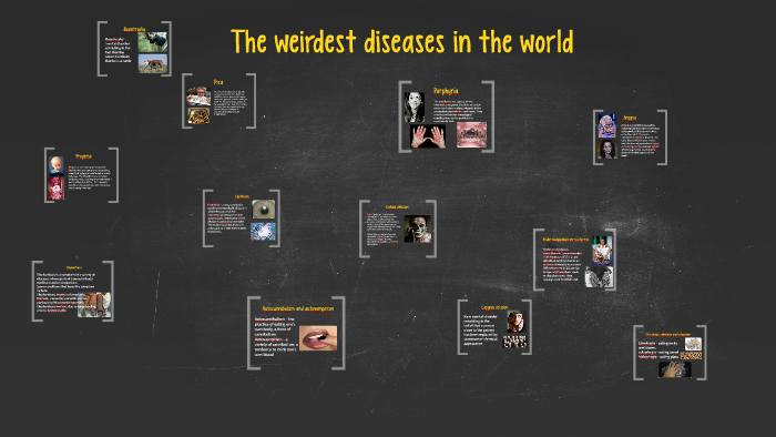 The weirdest diseases in the world by Madziak iPrzygoda on Prezi