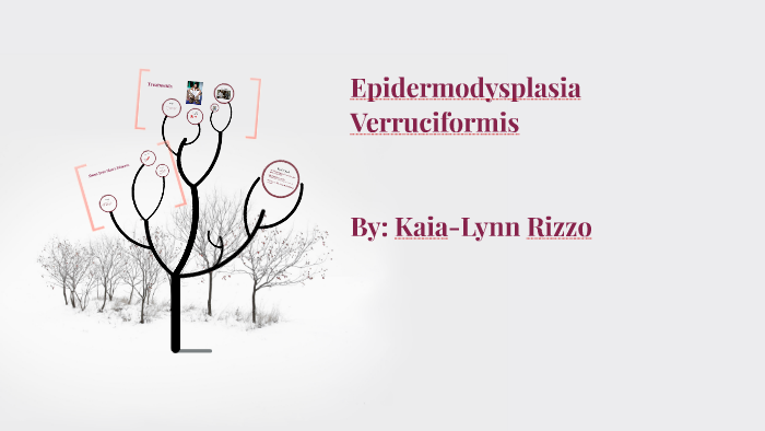 Tree Man's Disease (Epidermodysplasia verruciformis) by Kaia Bowen on Prezi