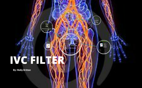 IVC FILTER by holly britton on Prezi