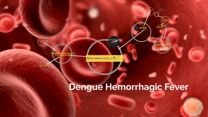 Dengue Hemorrhagic Fever by Thanjira Sanor on Prezi