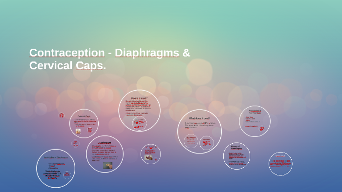 Contraception - Diaphragms & Cervical Caps. by Kiersten Goines