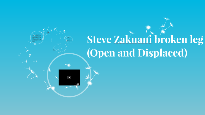 Steve Zakuani broken leg by Alexis Parsons on Prezi