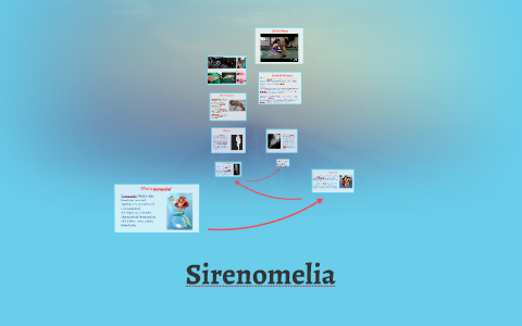 Sirenomelia by Brittany Guzman on Prezi
