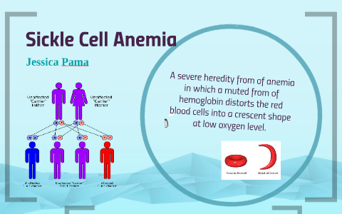 Sickle Cell Anemia by jessica pama on Prezi