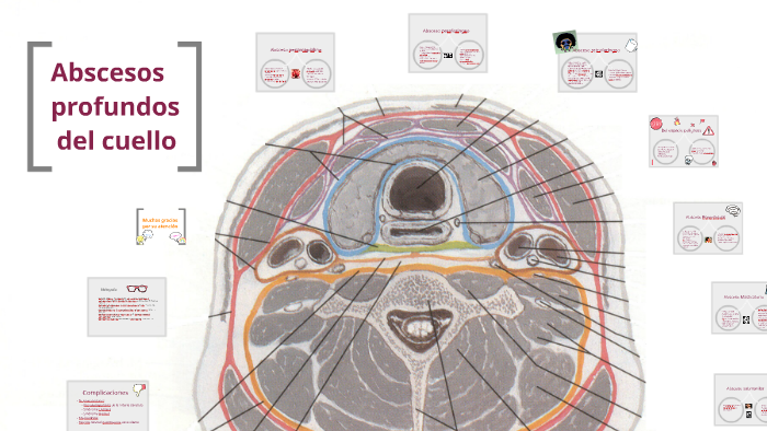 Abscesos by Macarena Velázquez on Prezi
