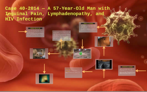 Case 40-2014 — A 57-Year-Old Man with Inguinal Pain, Lymphad by Cynthia ...