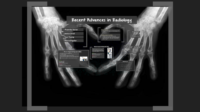 Recent Advances in Radiology by .. .. on Prezi