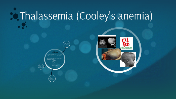 Thalassemia (Cooley's anemia) by Arianna Perez on Prezi