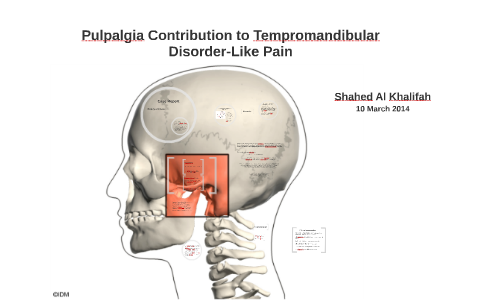 Pulpalgia Contributing to Tempromandibular Disorder-Like Pai by rasha ...