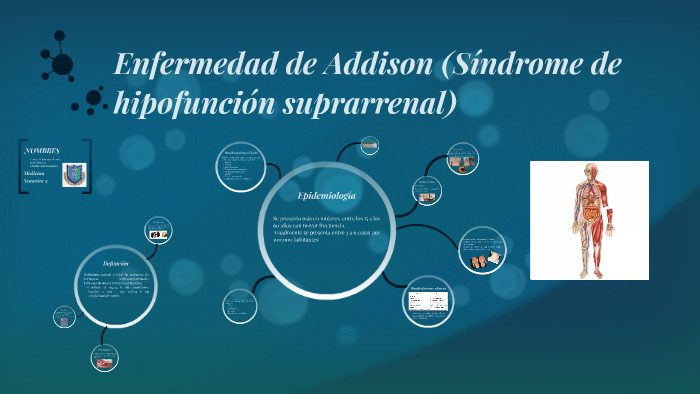 Enfermedad de Addison (Sindrome de hipofuncion suprarrenal) by Daniela ...