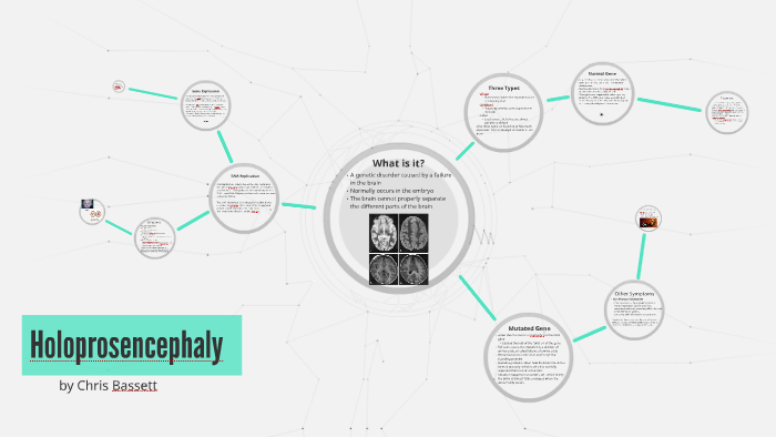 Holoprosencephaly by on Prezi