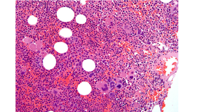 The Role of Histone Demethylase JMJD1C in the Pathophysiolog by Elias ...