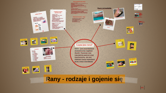 Rany - rodzaje i gojenie się by aleksandra michalska on Prezi
