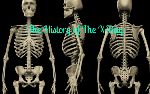 x-ray history by L D on Prezi
