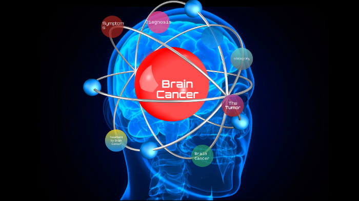 Brain Cancer project by themba Mashama on Prezi