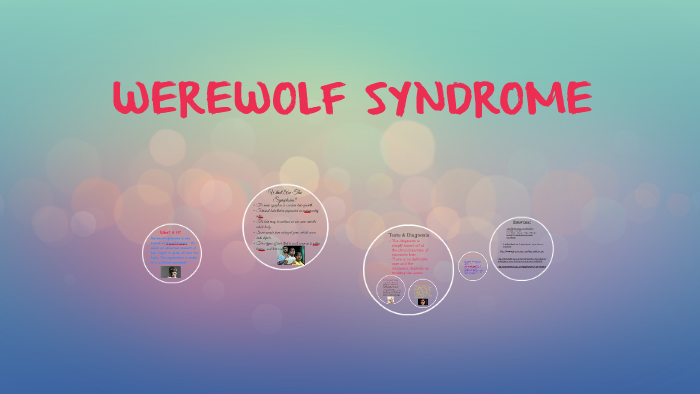 Werewolf Syndrome by Aliyah Parker on Prezi