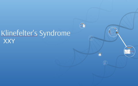 Klinfelter's by maria birova on Prezi