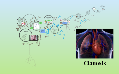Cianosis by Brenda Barba on Prezi