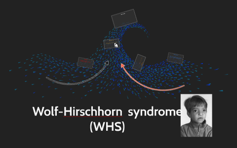 Wolf-Hirschorn syndrome by Isaiah Johnson on Prezi
