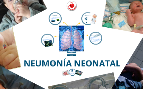 Neumonía Neonatal by Carlos Hoyos on Prezi