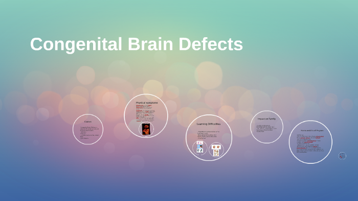 Congenital Brain Defects by hannah` chastain on Prezi