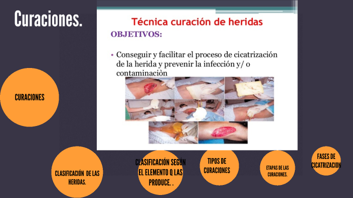 Curaciones by Nadia Soria on Prezi
