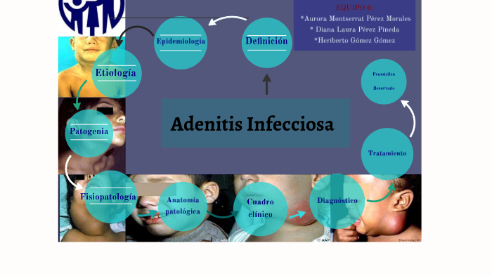 Adenitis infecciosa by Heriberto Gómez on Prezi