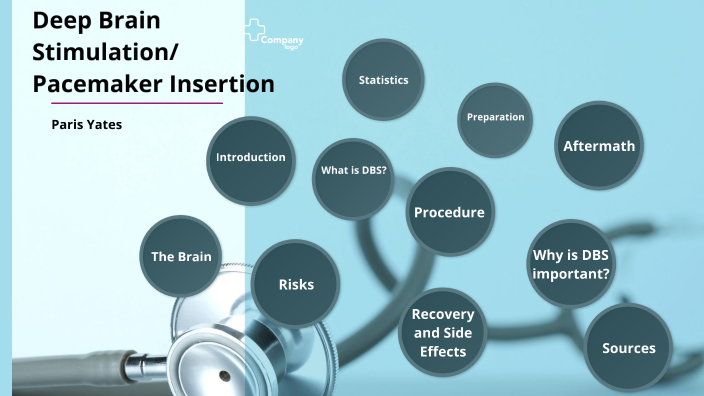 Deep Brain Stimulation (Pacemaker Insertion) by Paris Yates on Prezi