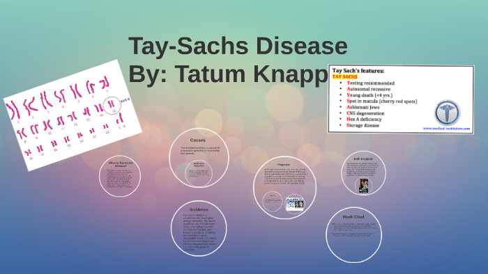 Tay-Sachs Disease by Tatum` Knapp on Prezi