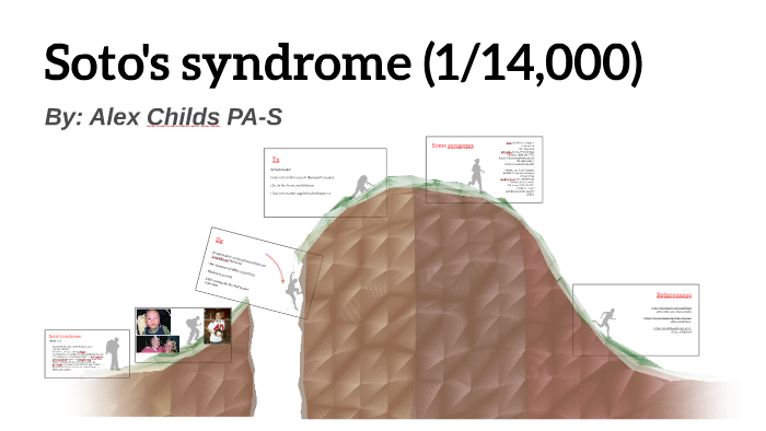Soto's syndrome by on Prezi