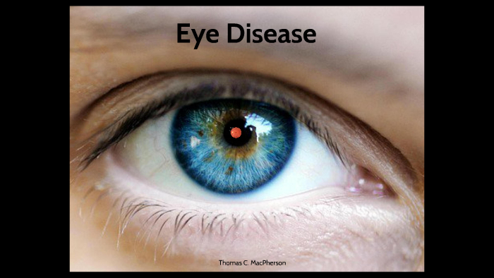 The Human Eye by Thomas MacPherson on Prezi