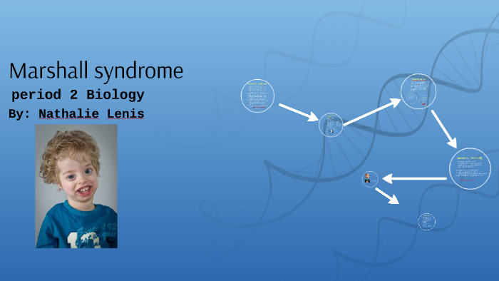 Marshall syndrome by Nathalie Lenis on Prezi