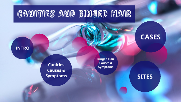 Canities and Ringed hair by olivia bradshaw on Prezi
