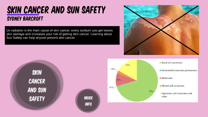 Skin Cancer and Sun Safety by sydney Barcroft on Prezi