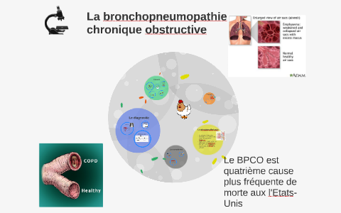 La bronchopneumopathie chronique obstructive by eva anderson on Prezi