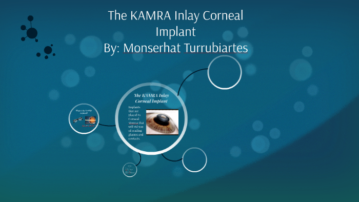 The KAMRA Inlay Corneal Implant by Monserhat Turrubiartes on Prezi