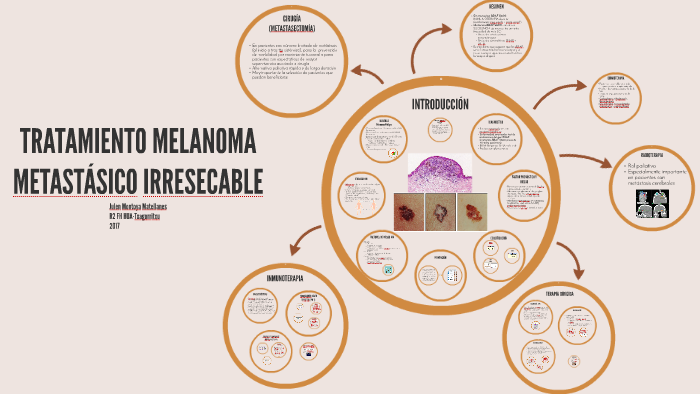 TRATAMIENTO MELANOMA METASTÁSICO IRRESECABLE by Julen Montoya ...