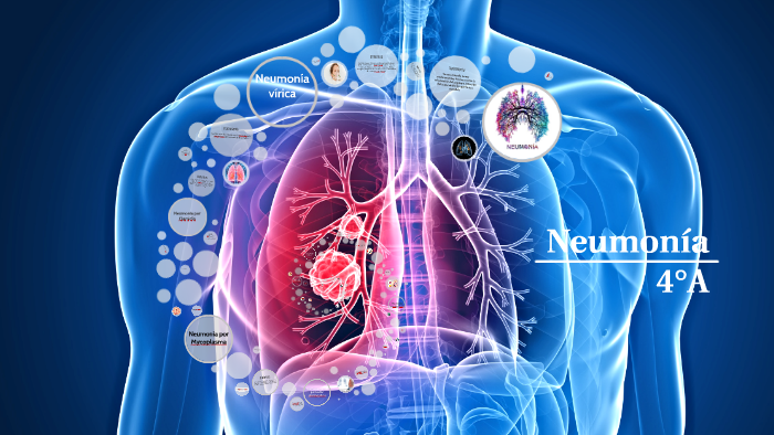 ¿QUE ES LA NEUMONIA? by Gonzalo Fernandez on Prezi
