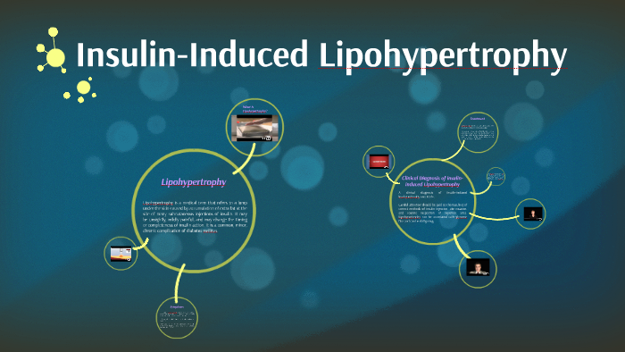 Insulin-Induced Lipohypertrophy by Cynthia De la Torre on Prezi