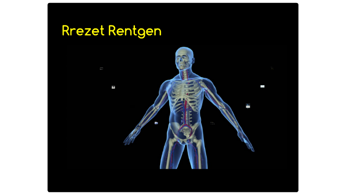 Rrezet Rentgen by Xhemal Ristami on Prezi
