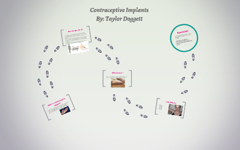 Contraceptive Implants by Taylor Doggett on Prezi