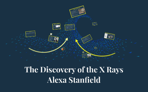 The X-Ray Machine by Alexa Stanfield on Prezi