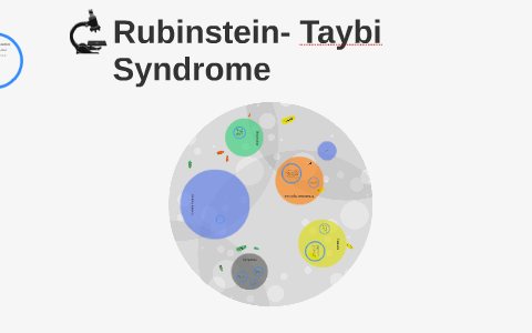 Rubinstein- Taybi Syndrome by Erin Reetz on Prezi