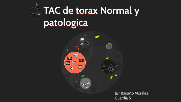 TAC de torax Normal y patologica by Jair Basurto on Prezi