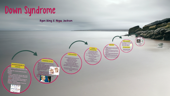Down Syndrome by Ryan King on Prezi