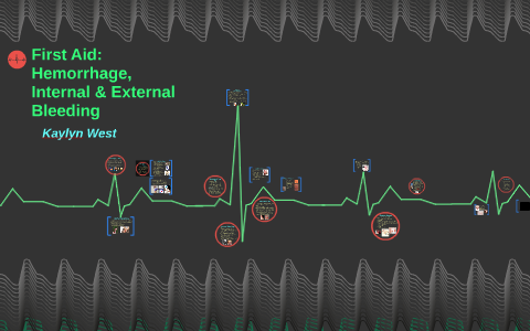 First Aid: Hemorrhage, Internal & External Bleeding by Kaylyn West on Prezi