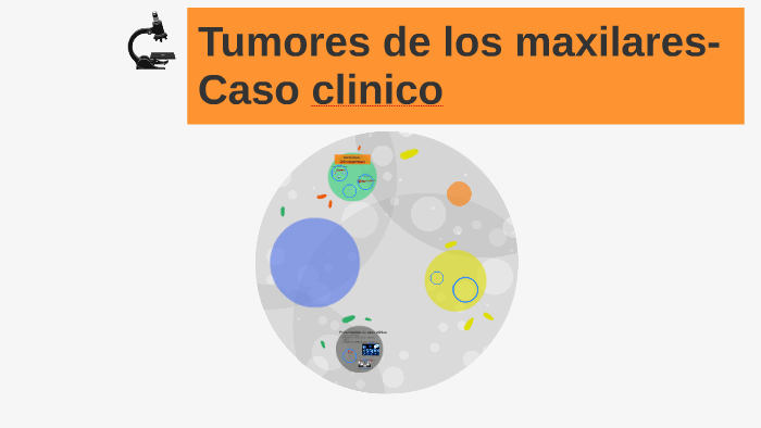 TUMORES DE LOS MAXILARES by on Prezi