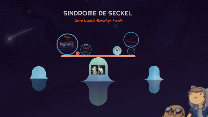 SINDROME DE SECKEL by Laura Daniela on Prezi
