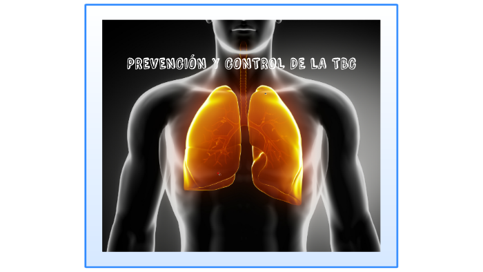 PREVENCIÓN Y CONTROL DE LA TBC by Jean Paul Asencios Hidalgo on Prezi
