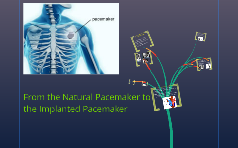 From the Natural Pacemaker to the Pacemaker Implant by JaBria Wilkins ...